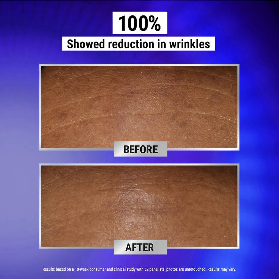 Kiehl's Launches New Fast Release Retinol | EDGE United States